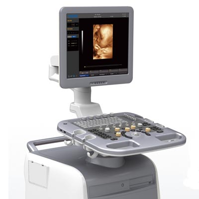 Chison i3 4D Renkli Doppler Ultrason Cihazı